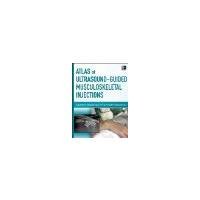 Atlas of Ultrasound-Guided Musculoskeletal Injections by Malanga ...