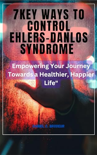7KEY WAYS TO CONTROL EHLERS-DANLOS SYNDROME : Ehlers danlos syndrome ...