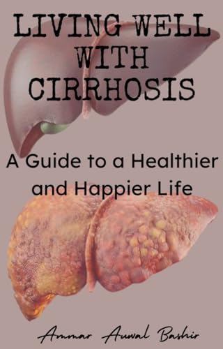 Living Well with Cirrhosis : A Guide to a Healthier and Happier Life by ...