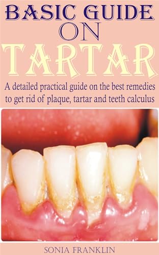 BASIC GUIDE ON TARTAR: A detailed practical guide on the best remedies ...