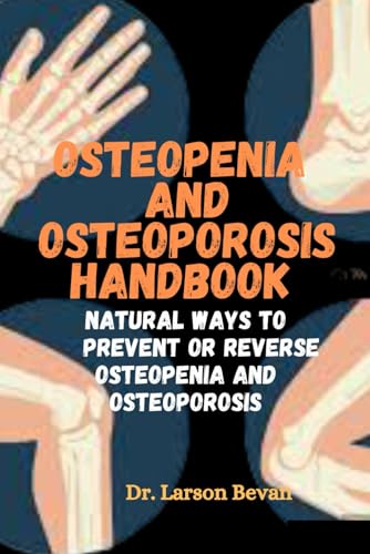 Osteopenia and Osteoporosis Handbook: Natural ways to prevent or ...