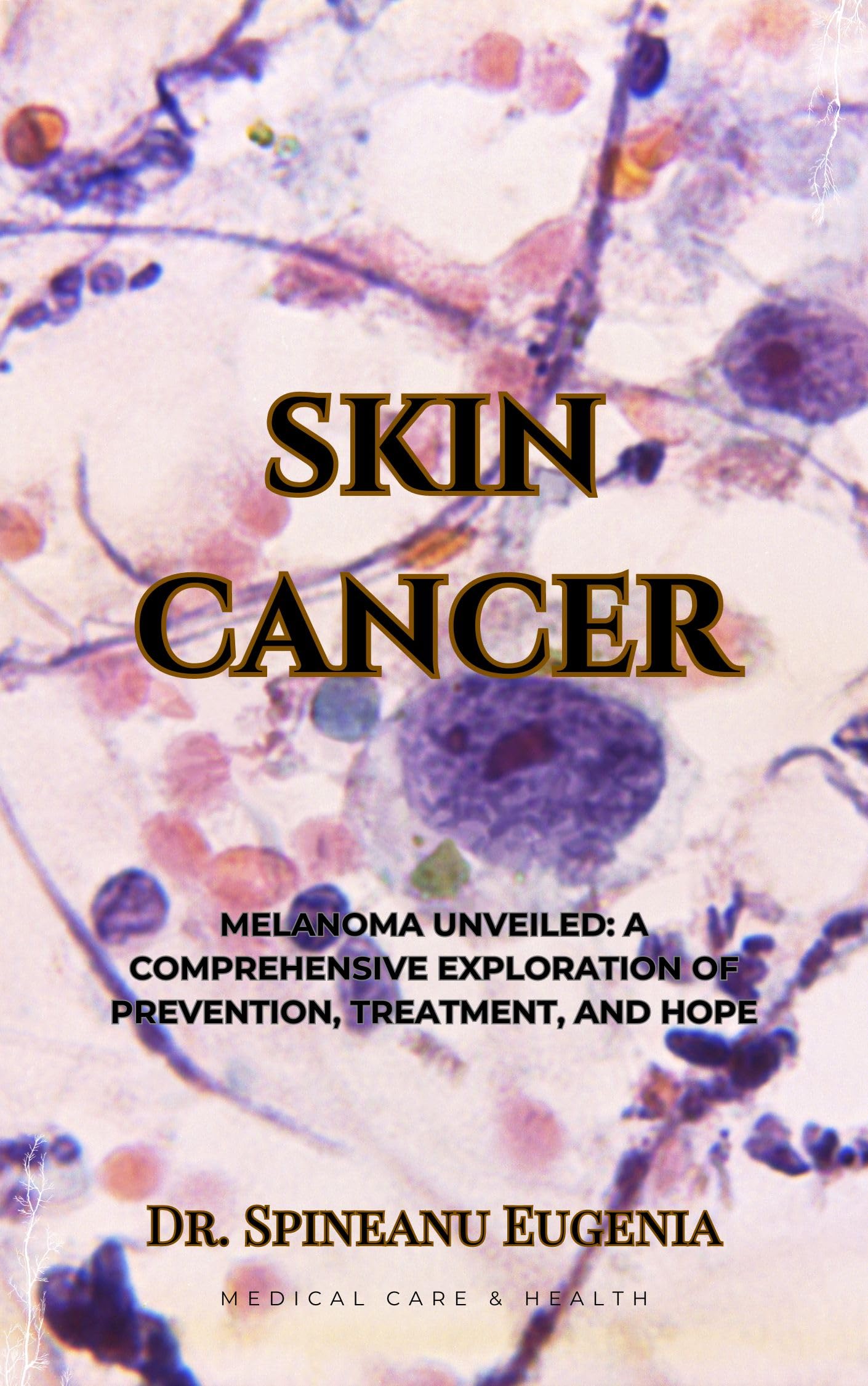 Melanoma Unveiled: A Comprehensive Exploration of Prevention, Treatment ...