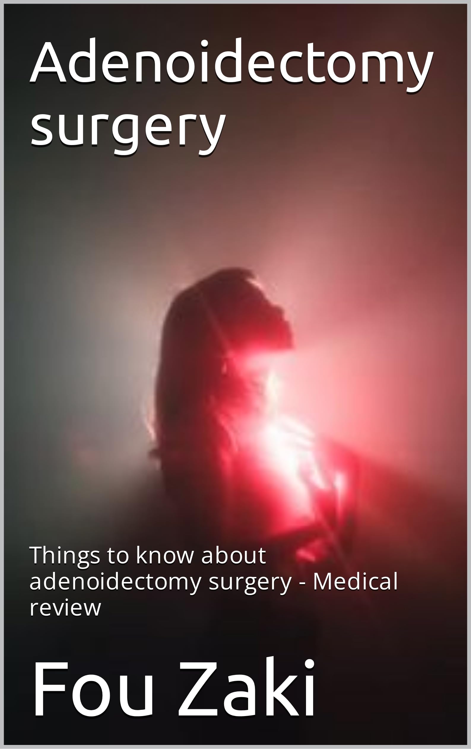 Adenoidectomy surgery: Things to know about adenoidectomy surgery ...