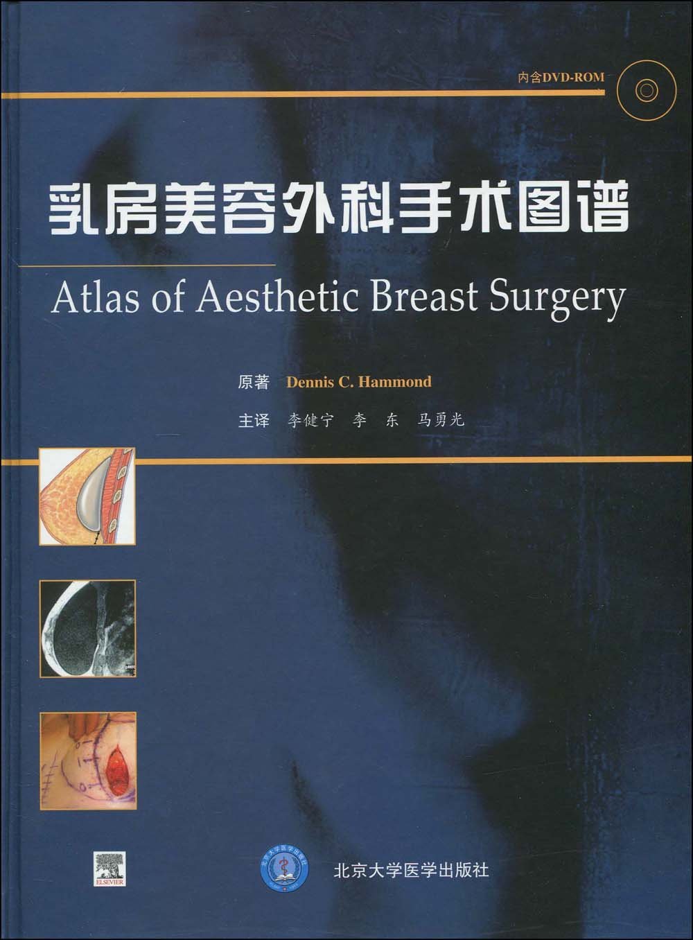 Breast cosmetic surgery map (comes with a VCD discs) by MEI DAN NI SI ...