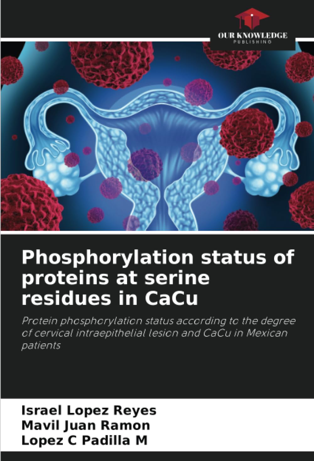 Phosphorylation status of proteins at serine residues in CaCu: Protein ...
