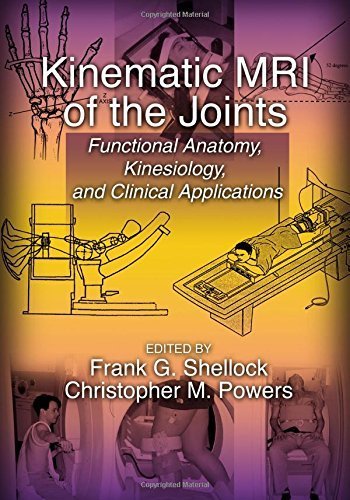 Kinematic MRI of the Joints: Functional Anatomy, Kinesiology, and ...