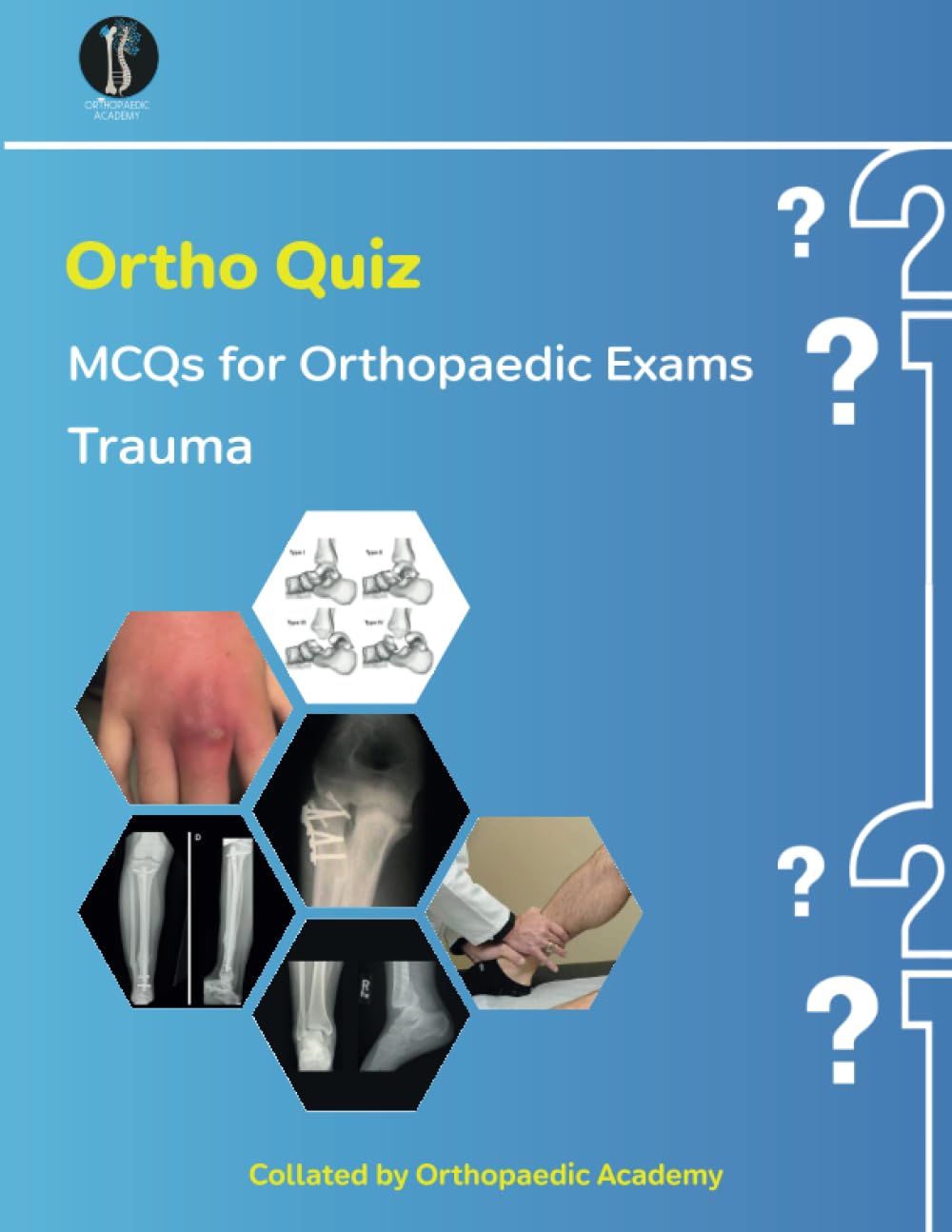 Ortho Quiz: Trauma MCQs (Concise Orthopaedics) by Orthopaedic Academy | Goodreads