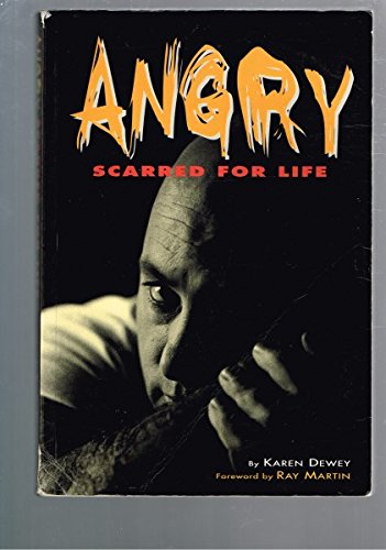 Angry: Scarred for life by Karen Dewey | Goodreads