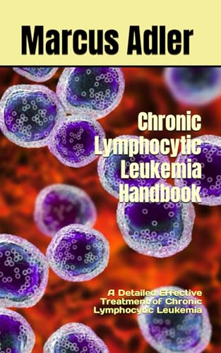 Chronic Lymphocytic Leukemia Handbook: A Detailed Effective Treatment ...