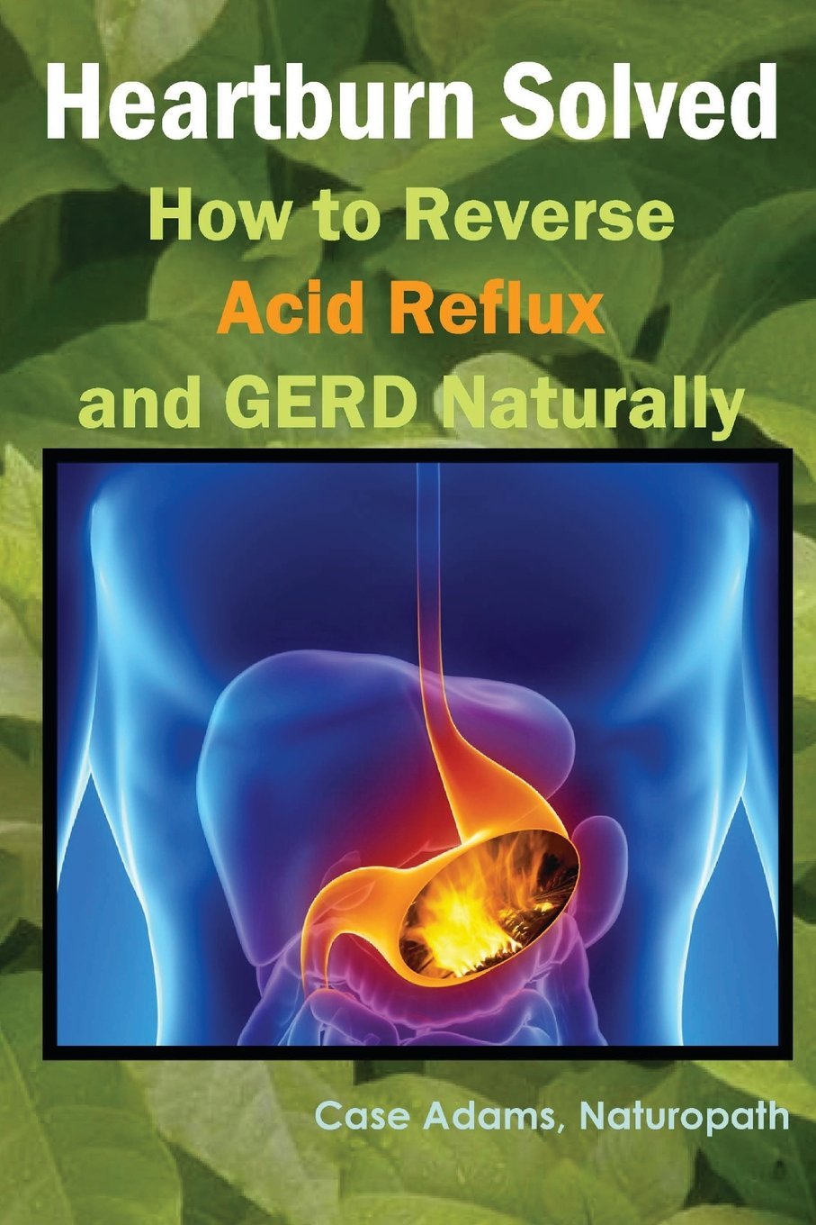 Heartburn Solved: How to Reverse Acid Reflux and GERD Naturally by Case ...