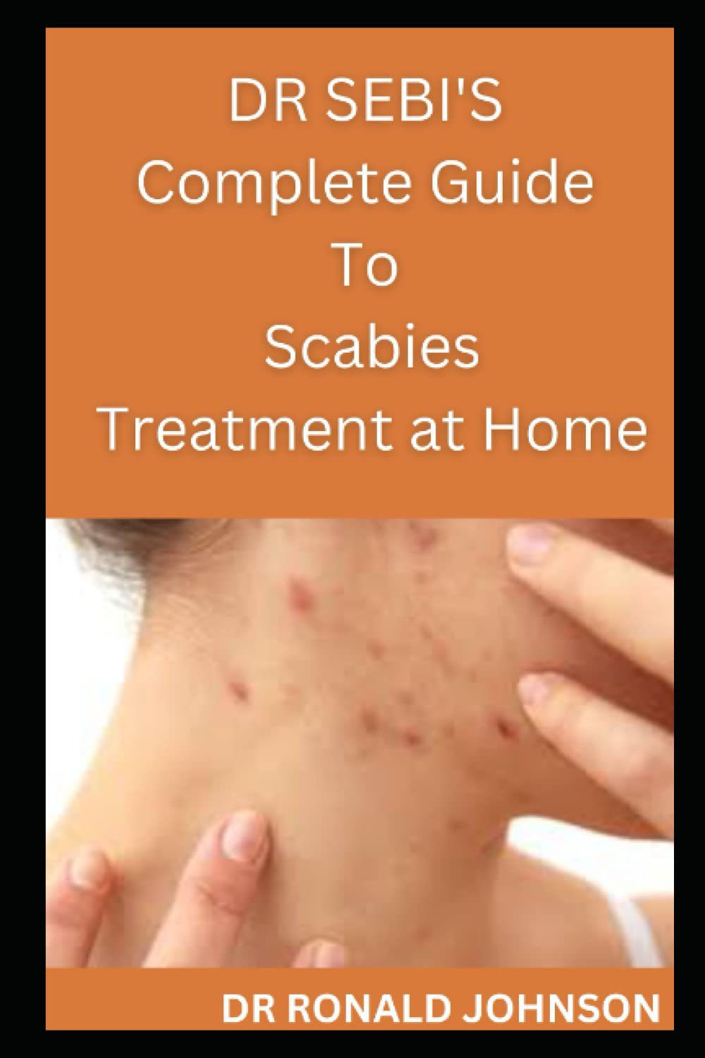 DR SEBI'S COMPLETE GUIDE TO SCABIES TREATMENT AT HOME by DR RONALD ...