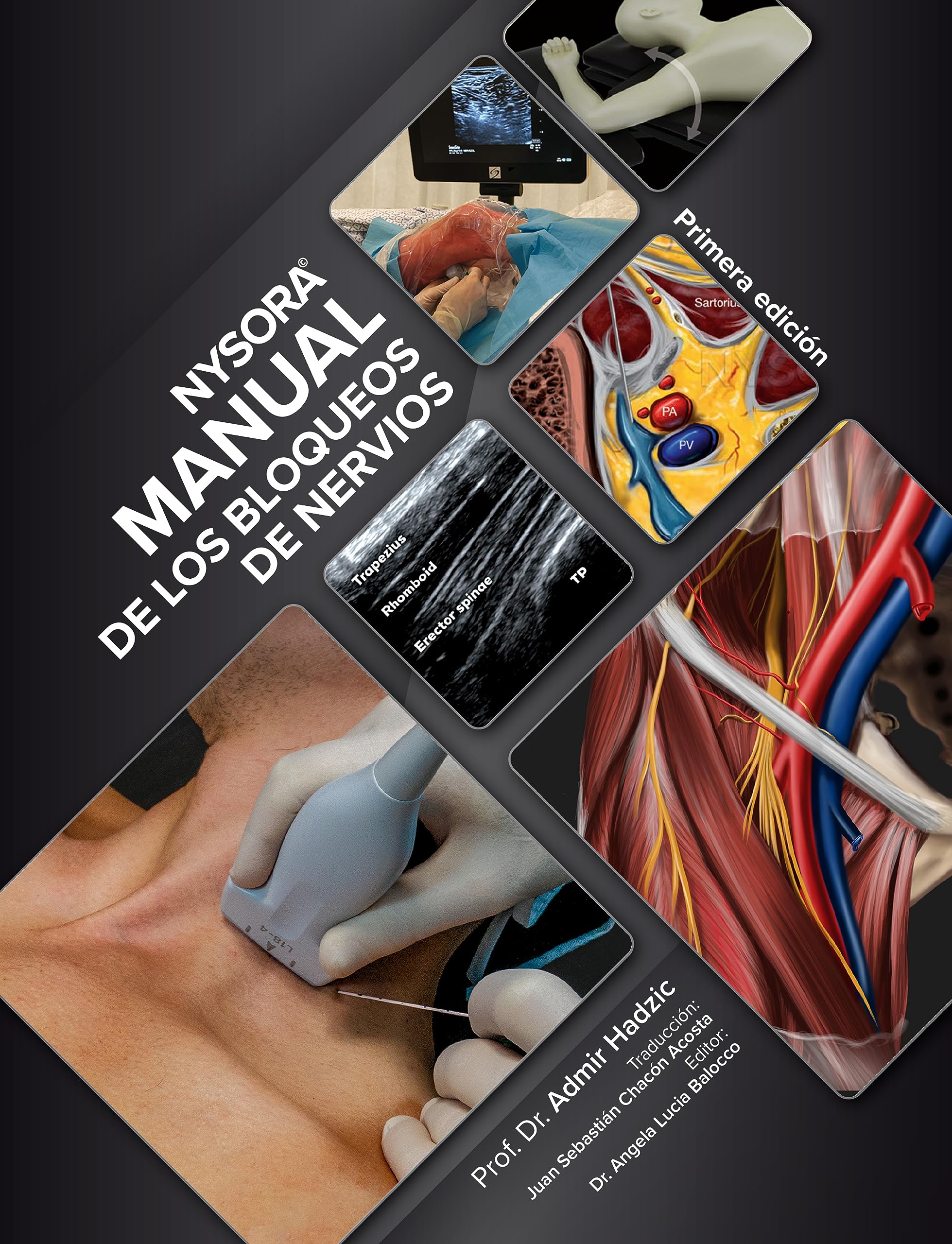 NYSORA Manual de los Bloqueos de Nervios: Primera Edición: NYSORA Nerve ...