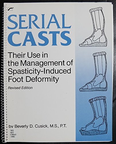 Serial Casts: Their Use in the Management of Spasticity-Induced Foot ...