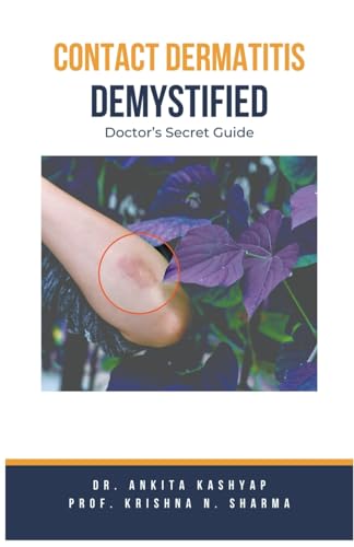 Contact Dermatitis Demystified: Doctor's Secret Guide by Dr Ankita ...