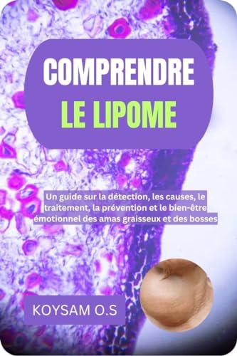 COMPRENDRE LE LIPOME : Un guide sur la détection, les causes, le ...