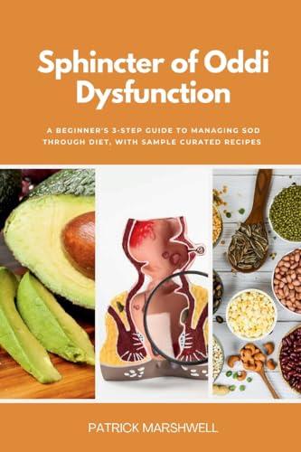 Sphincter of Oddi Dysfunction: A Beginner's 3-Step Guide to Managing ...