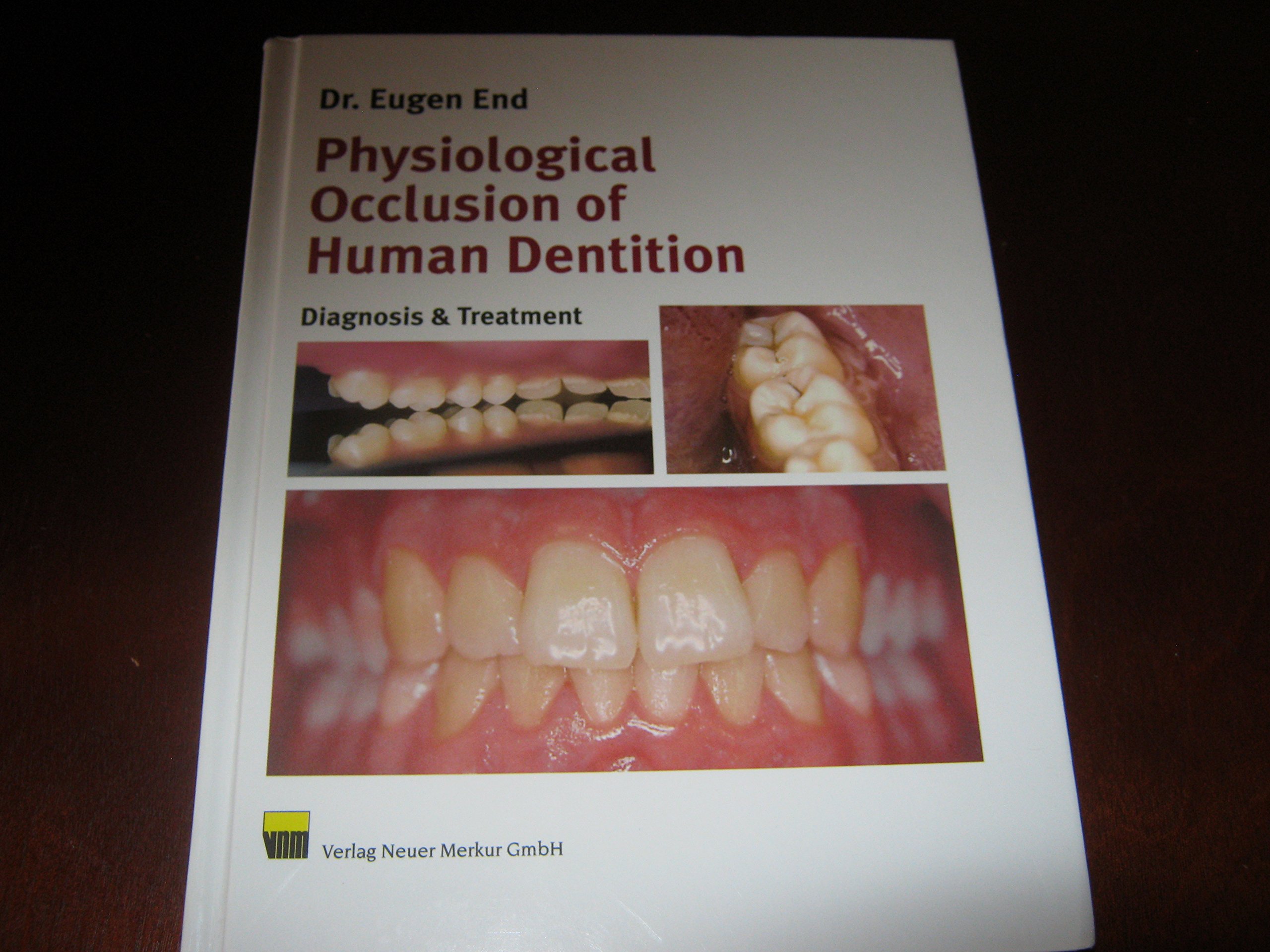 Physiological Occlusion Of Human Dentismdiagnosis & Treatment by Eugen ...