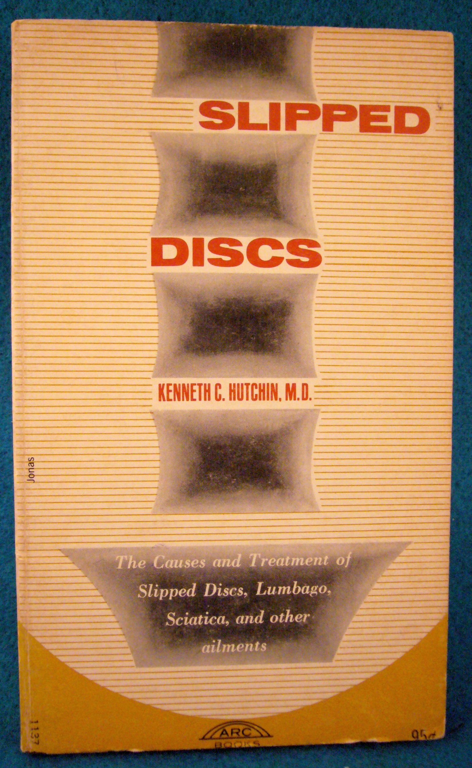 Slipped Discs by Kenneth C. Hutchin | Goodreads