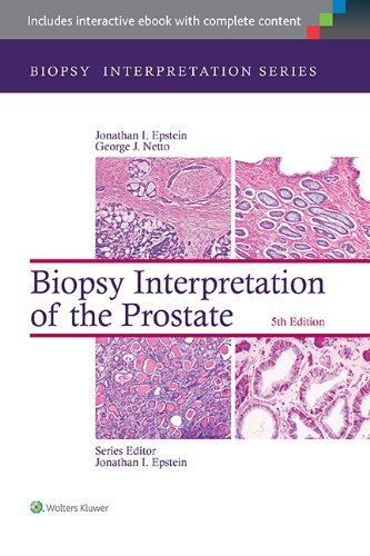 By Jonathan I. Epstein Biopsy Interpretation of the Prostate (Biopsy ...