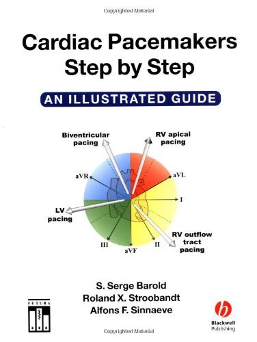 Cardiac Pacemakers Step-by-Step: An Illustrated Guide by S. Serge ...