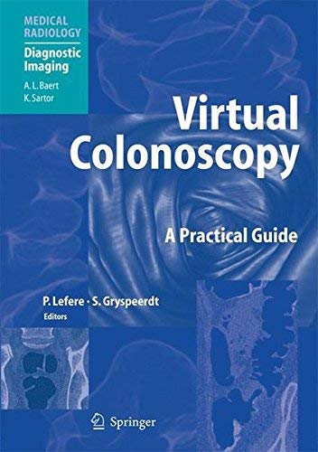 virtual_colonoscopy-a_practical_guide by philippe-lefere-stefaan ...