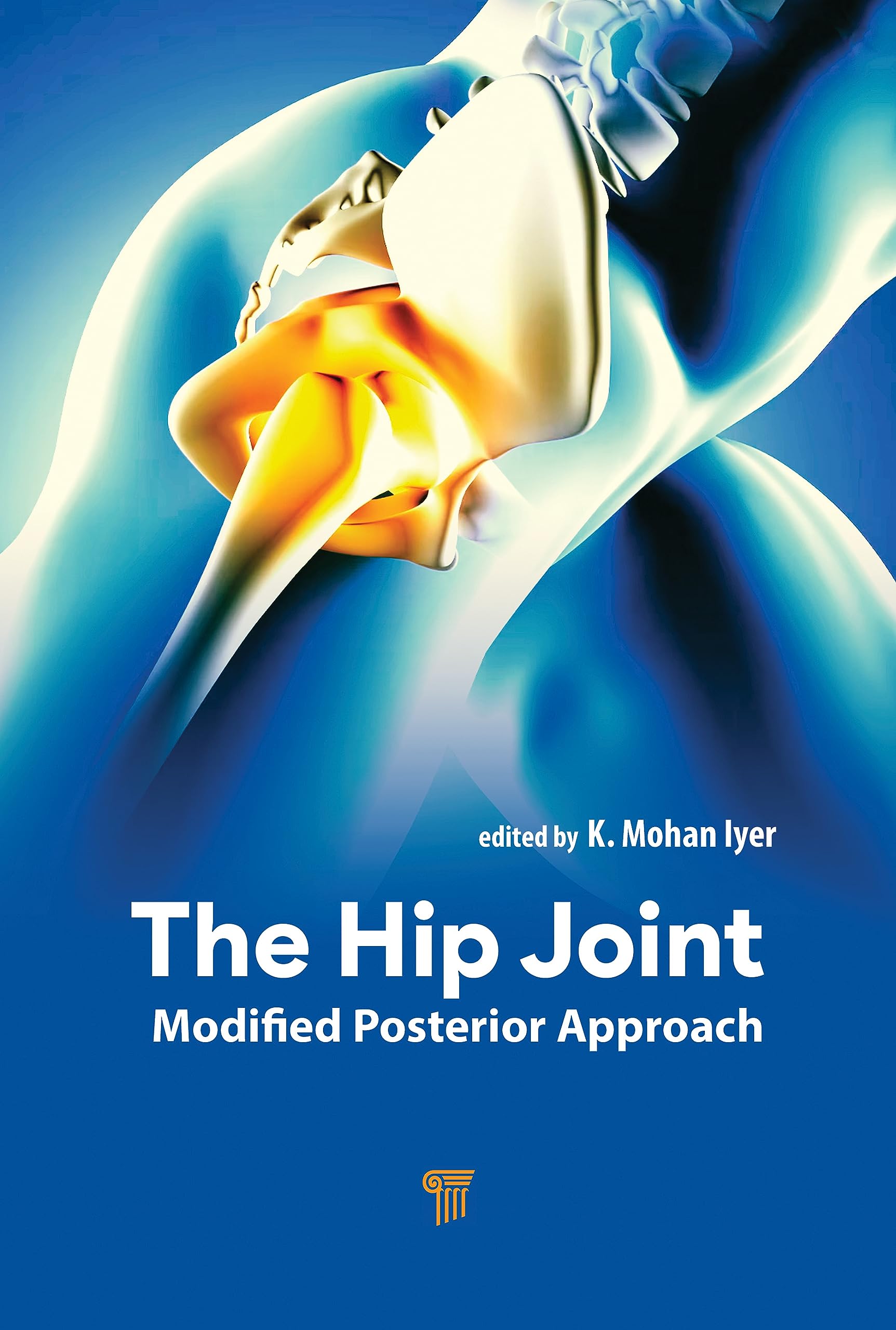 The Hip Joint: Modified Posterior Approach by K. Mohan Iyer | Goodreads