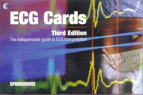 ECG Cards: The indispensible guide to ECG interpretation by Springhouse ...