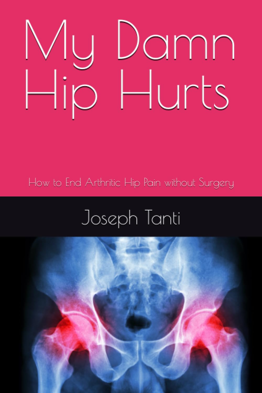 My Damn Hip Hurts: How to End Arthritic Hip Pain without Surgery by Dr ...