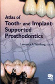Atlas of Tooth- And Implant-Supported Prosthodontics by Lawrence A ...