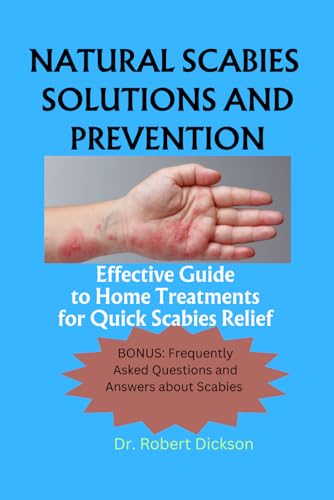 Scabies Treatment And Prevention – LMTYW