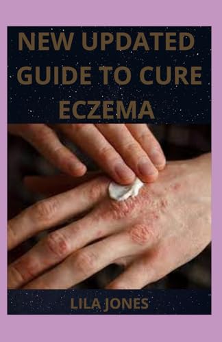 New Updated Guide To Cure Eczema: Complete Knowledge About Eczema, Treatments And Natural ...