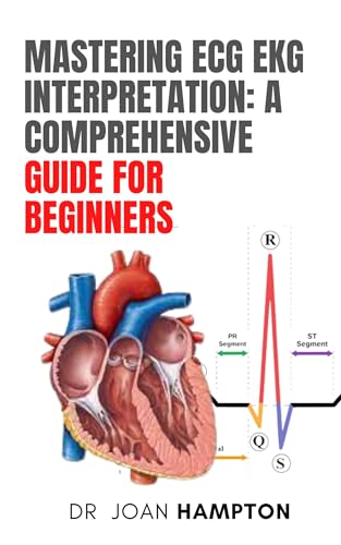 Mastering ECG EKG Interpretation: A Comprehensive Guide for Beginners: ECG Interpretation Made ...