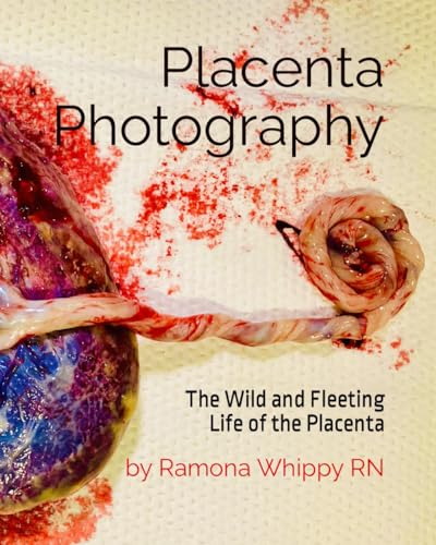 Placenta Photography: The Wild and Fleeting Life of the Placenta by ...
