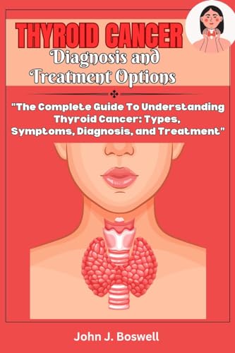 Thyroid cancer (Diagnosis And Treatment Options): "The Complete Guide ...
