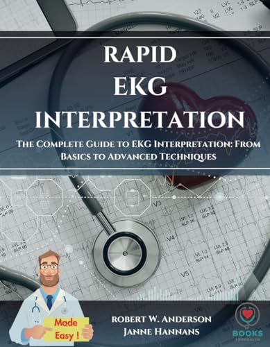 RAPID EKG INTERPRETATION: The Complete Guide to EKG Interpretation ...