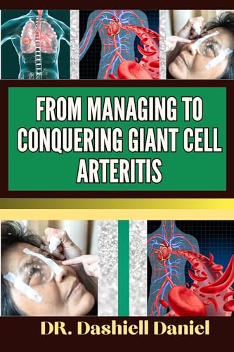 FROM MANAGING TO CONQUERING GIANT CELL ARTERITIS : Expert guide to ...