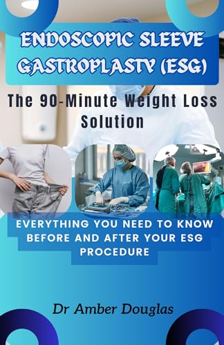 Endoscopic Sleeve Gastroplasty (ESG): The 90-Minute Weight Loss ...