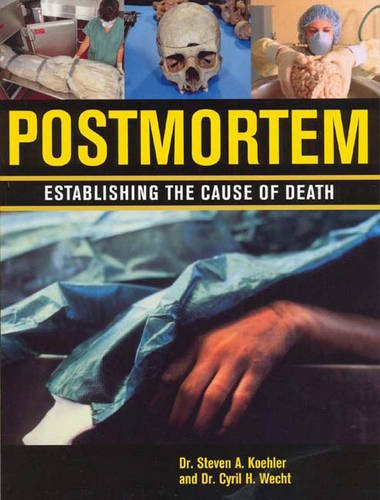 Postmortem: Establishing the Cause of Death by Steven A.; Wecht Koehler ...