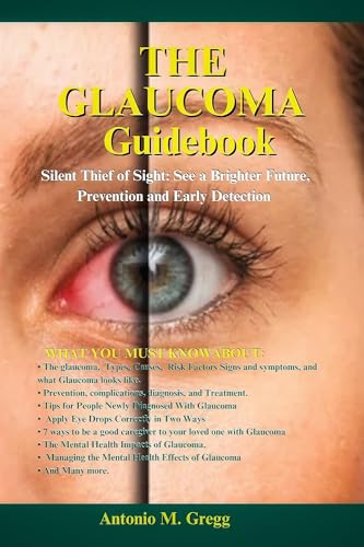 The Glaucoma Guide Book Silent Thief of Sight: See a Brighter Future ...