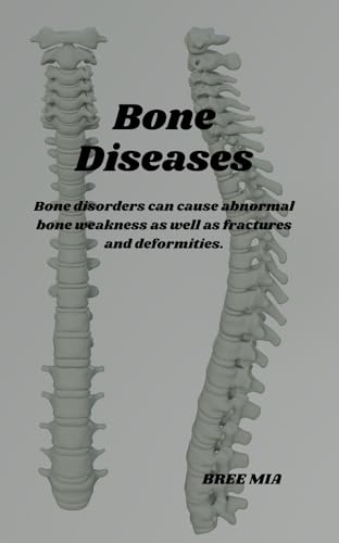 Bone Diseases: Bone disorders can cause abnormal bone weakness as well ...