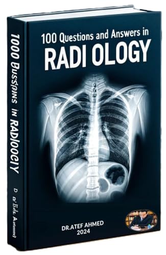 100 Questions and Answers in Radiology for Medical Students by Atef ...