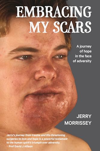 Embracing My Scars: A journey of hope in the face of adversity by Jerry ...