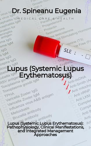 Lupus (Systemic Lupus Erythematosus): Pathophysiology, Clinical ...