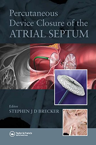 Percutaneous Device Closure of the Atrial Septum by Stephen J.D ...