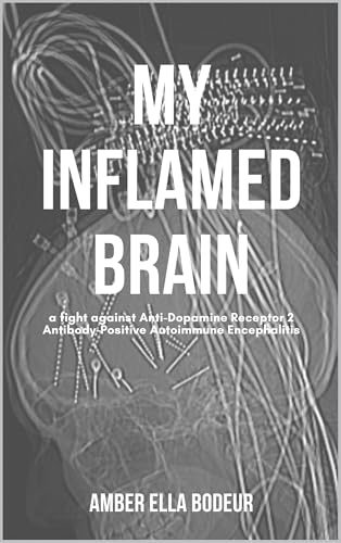My Inflamed Brain: a fight against Anti-Dopamine Receptor 2 Antibody ...