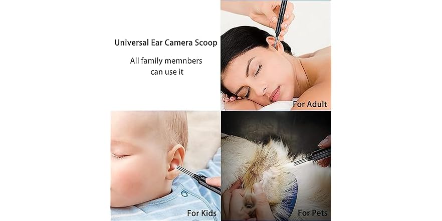 Ear Wax Removal with Camera