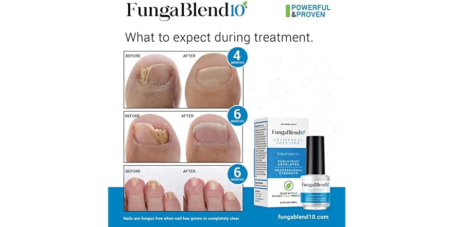 Tolnaftate Antifungal Solution