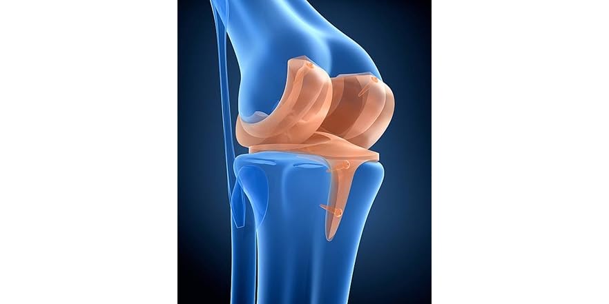 Evertone Titanium Flex Leg Compression Sleeve