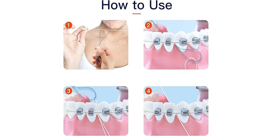 400 Count Floss Threaders for Braces