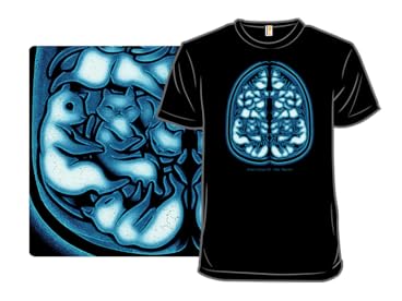 Cat Scan